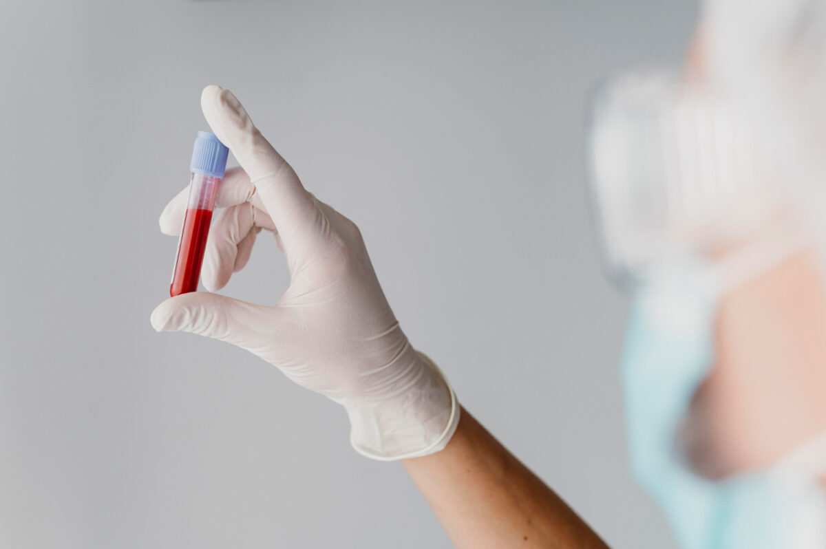 Amilasi pancreatica: cos'è e quando preoccuparsi - Centro Medico ...